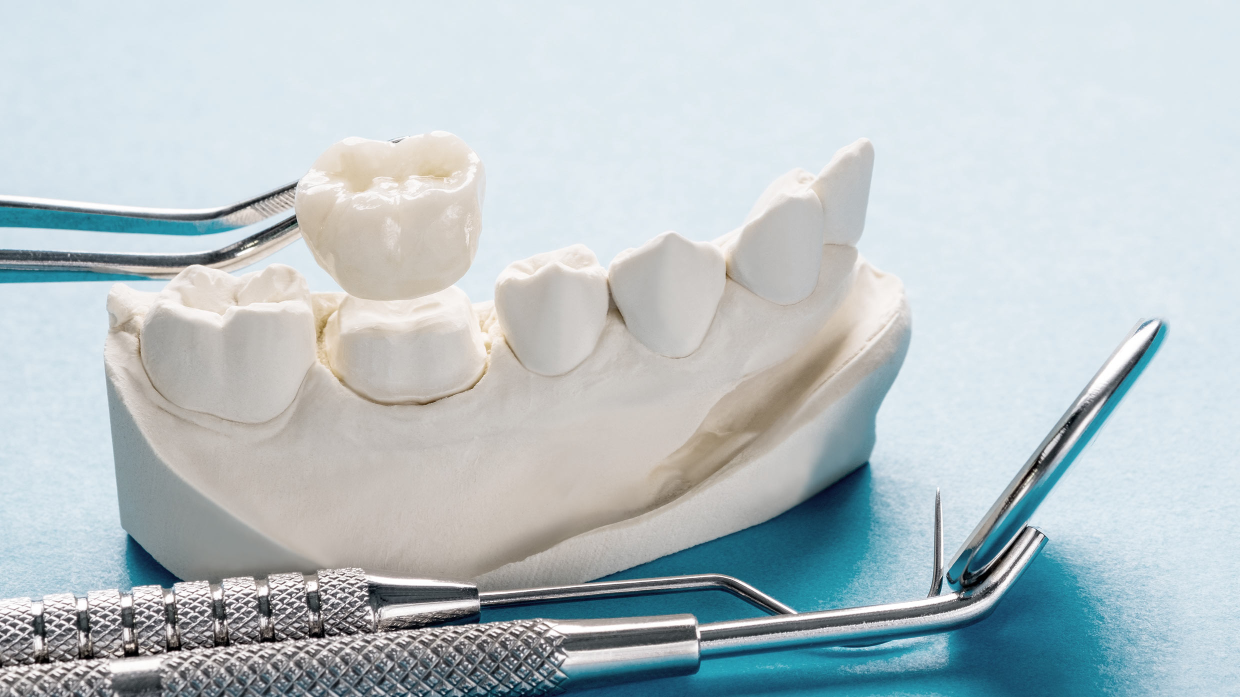 Corone dentali in zirconio - Centri Dentistici Primo