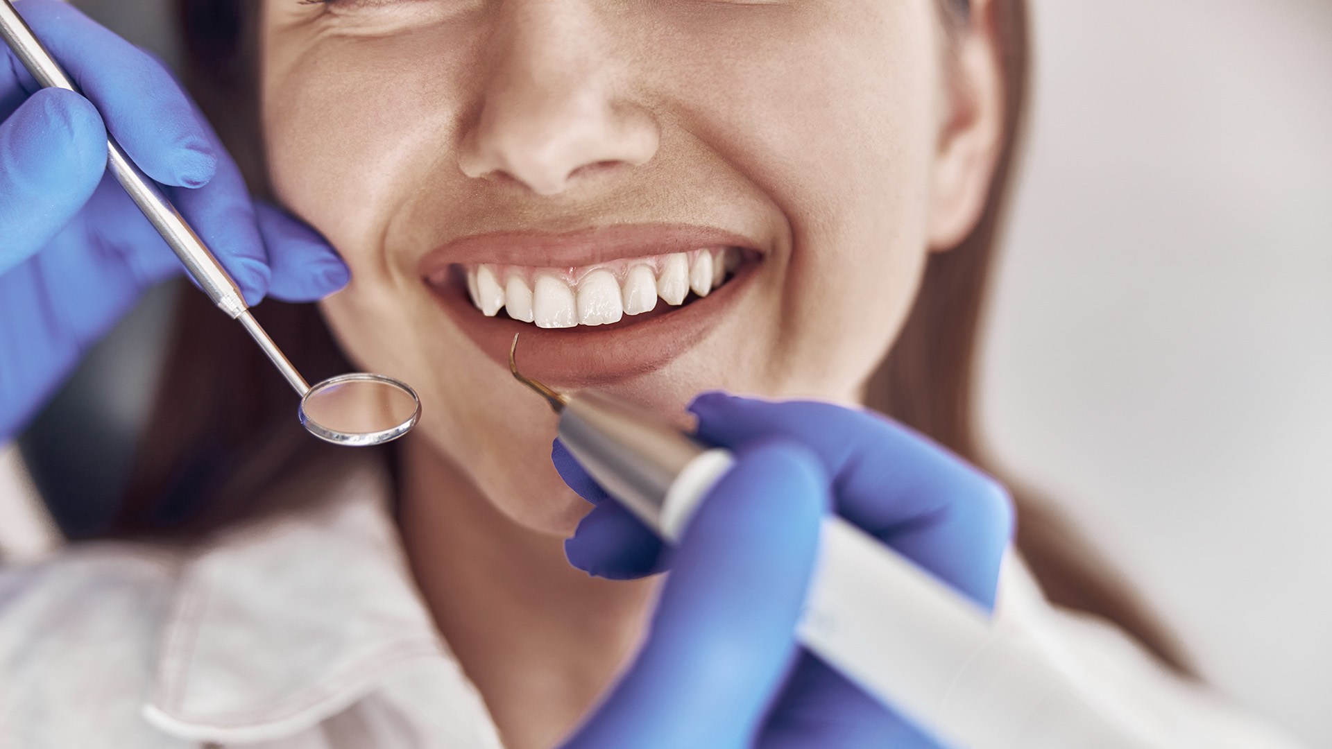 Quanto costa la pulizia dei denti dal dentista? - Centri Dentistici Primo